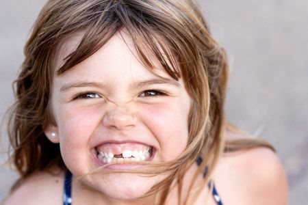 kad-se-mlecni-zub-rasklati | Yumama