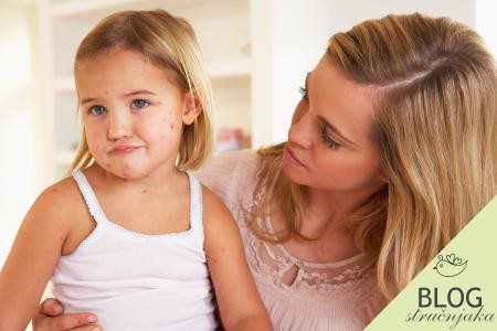 kako-prepoznati-i-leciti-male-boginje-morbile-kod-dece | Yumama