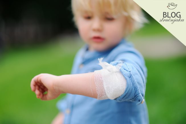 saveti-fizioterapeuta-koje-su-najcesce-sportske-povrede-kod-dece | Yumama