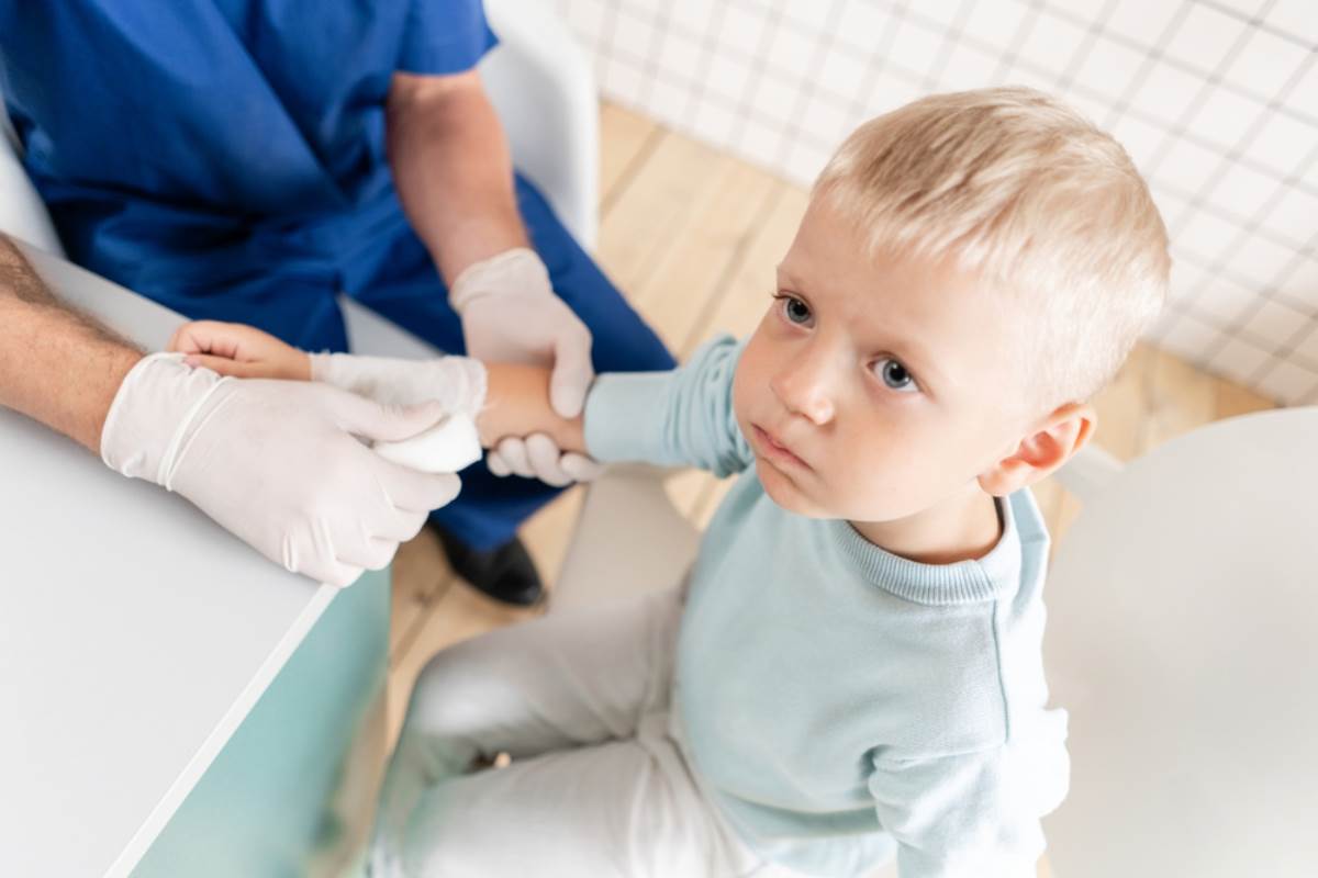 Opekotine kod dece - kako da im pomognete | Yumama