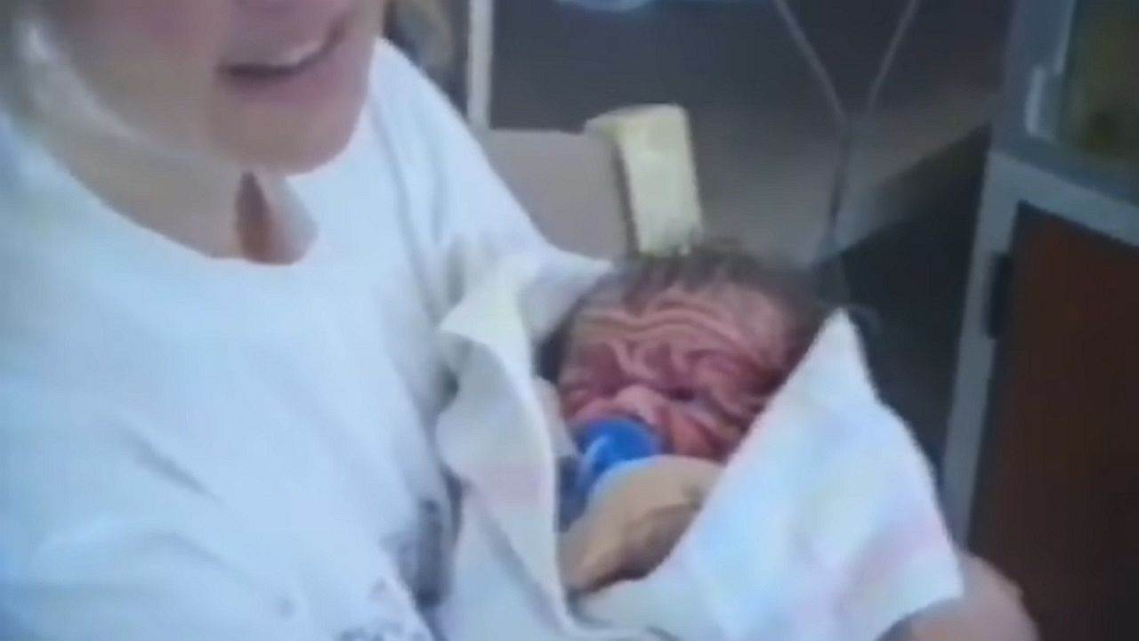 Kako danas izgleda beba rođena sa velikim viškom kože | Yumama