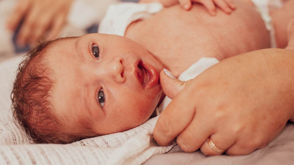 Skraćena resica kod beba | Yumama