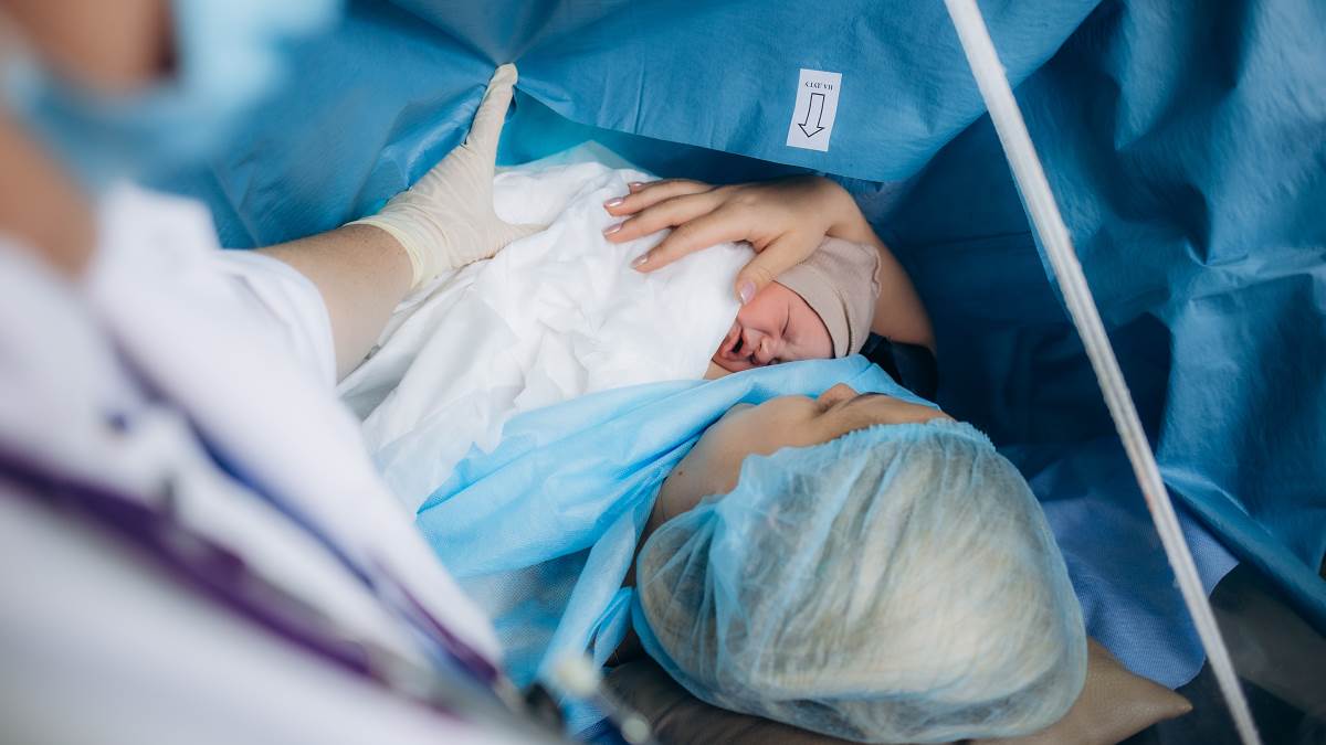 Da li više boli carski rez ili prirodni porođaj | Yumama