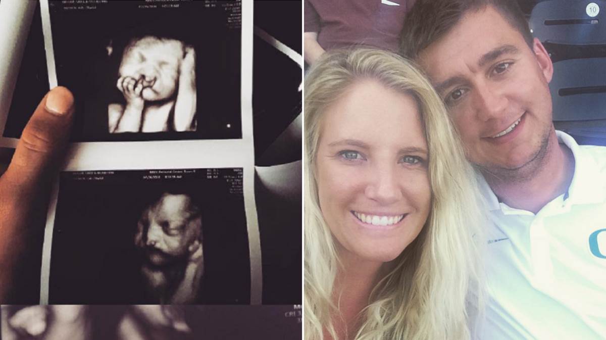 Kako izgleda dečak rođen sa rascepom usne i nepca | Yumama